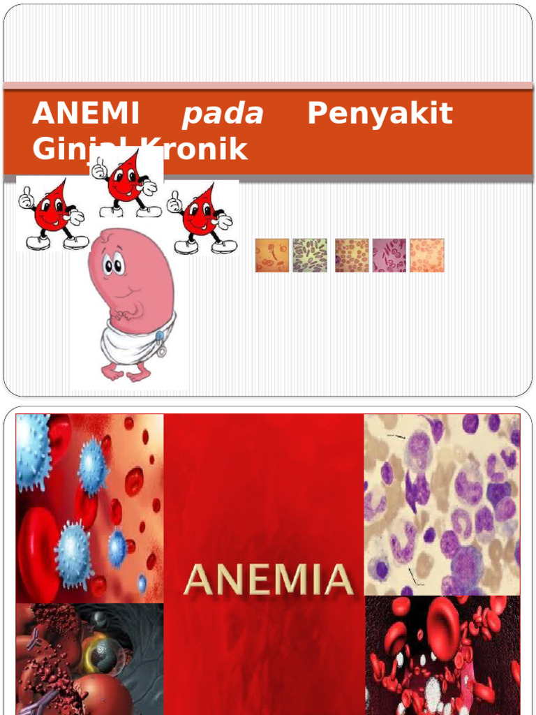 44. Manajemen Anemia Pada Pasien Dialisis (Hd Dan Pd) (1) | PDF | Anemia | Tissue (Biology)