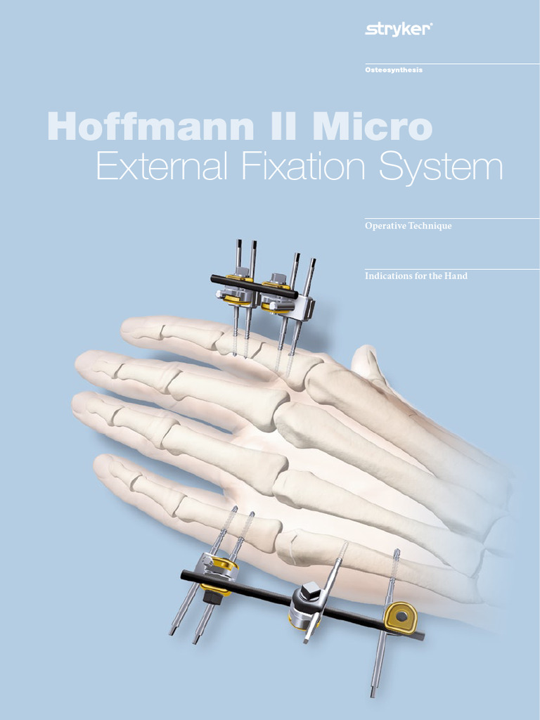 1-STRYKER External Fixation System | PDF | Screw