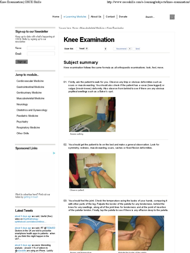 Knee Examination _ OSCE Skills | Knee | Joints
