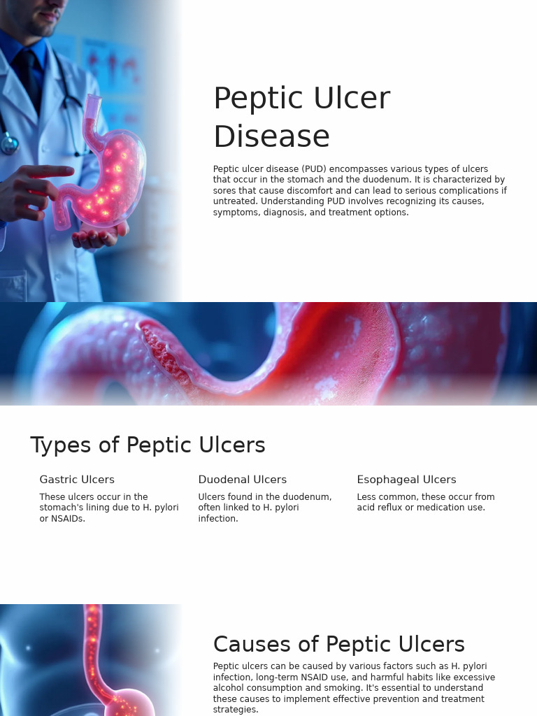 Peptic Ulcer Disease | PDF | Gastroenterology | Digestive Diseases
