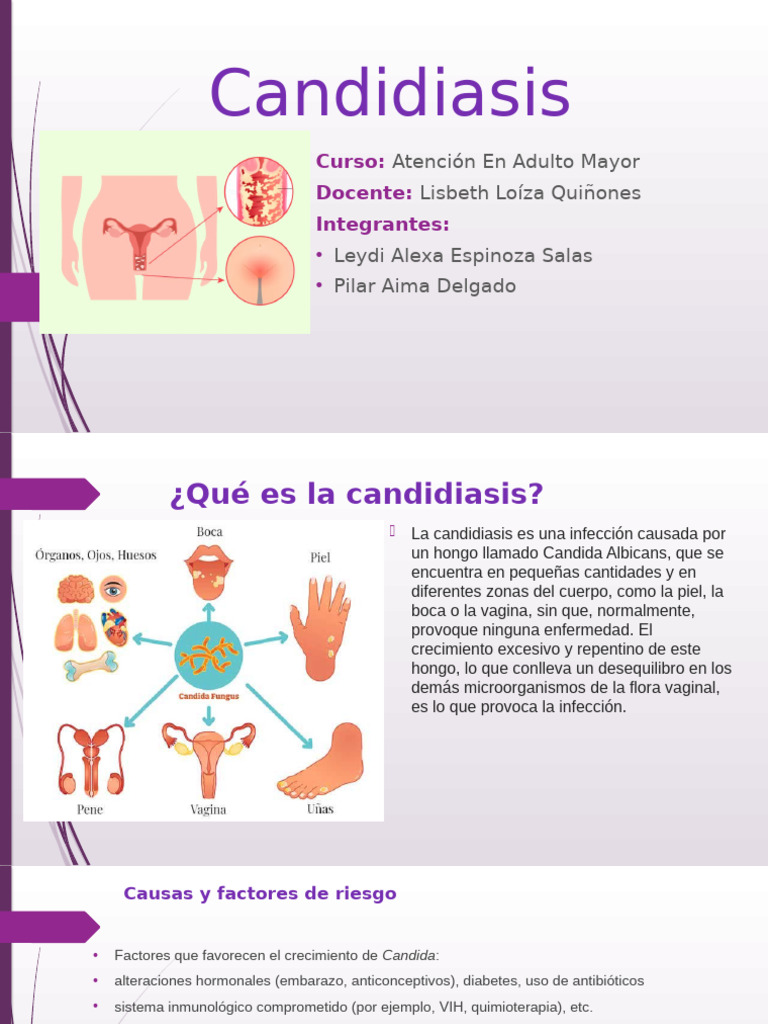 Candidiasis | PDF | Candidiasis | Ciencias de la Salud