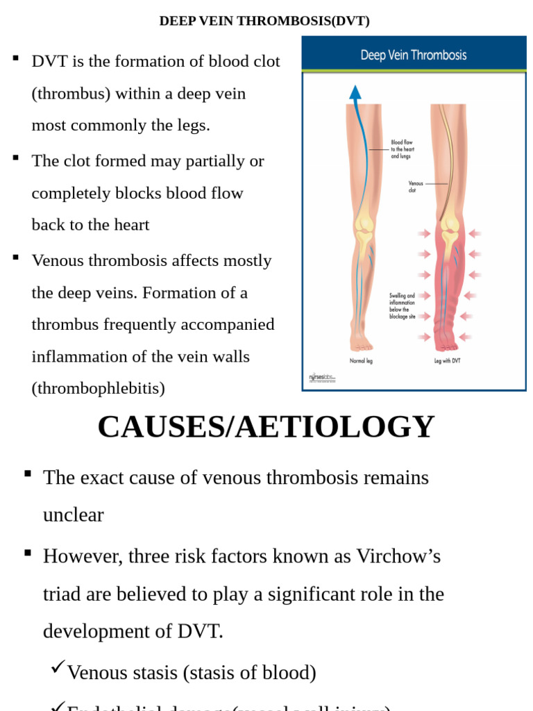 Deep Vein Thrombosis | PDF | Vein | Thrombus