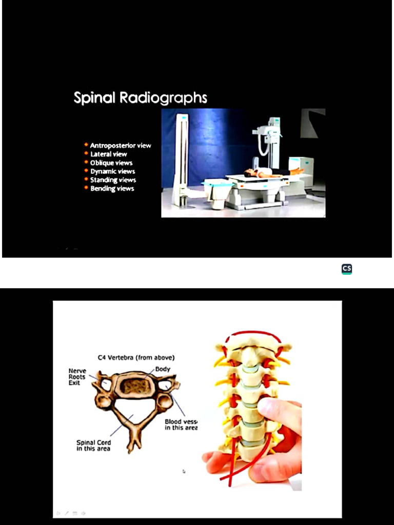 Spine Pdf