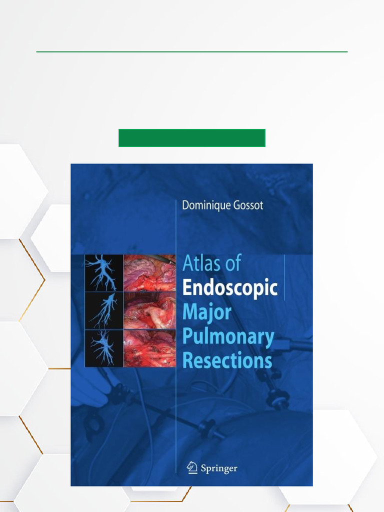 Atlas of Endoscopic Major Pulmonary Resections Open Access Download ...