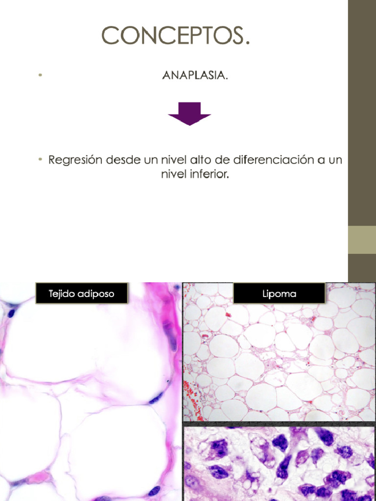 ANAPLASIA, DISPLASIA, REGULACIÓN CICLO CELULAR.0 | PDF