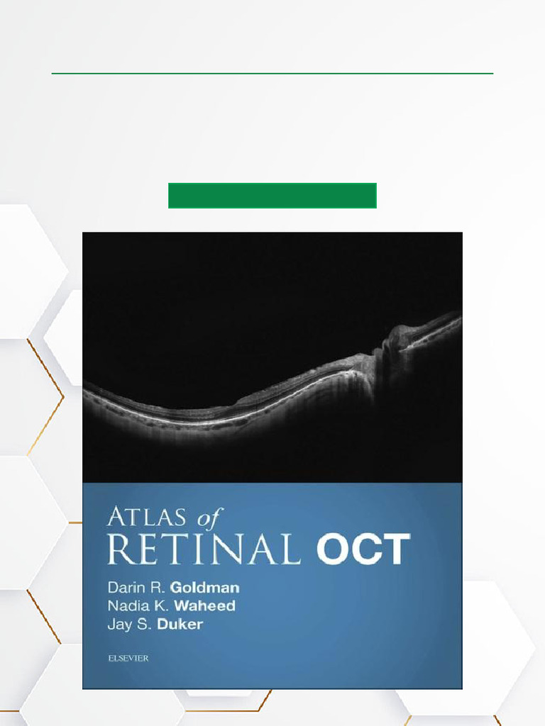 Atlas of Retinal OCT Optical Coherence Tomography No-Wait Download ...
