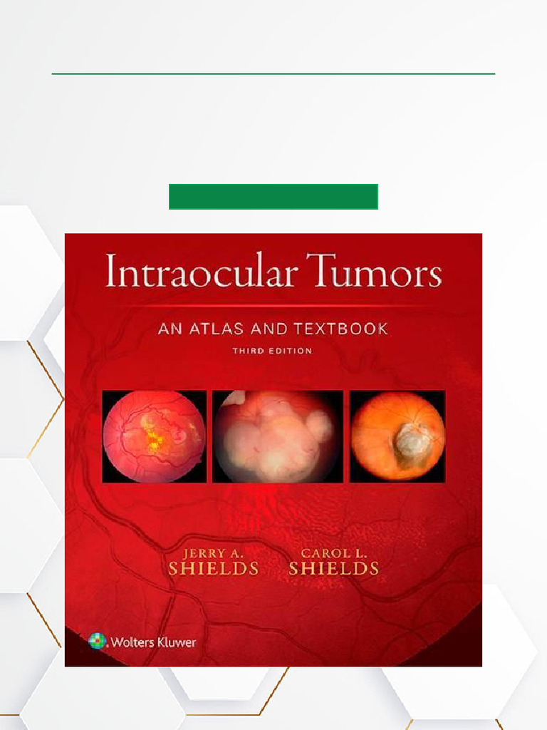 Intraocular Tumors: Market Insights | PDF | Adenoma | Melanoma