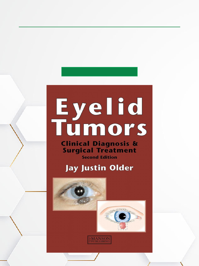Eyelid Tumors, 2nd Edition PDF | PDF | Neoplasms | Carcinoma