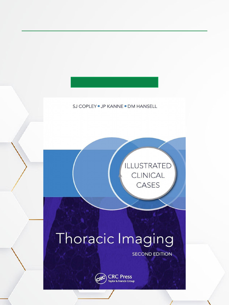 Thoracic Imaging Illustrated Clinical Cases, 2nd Edition Complete DOCX ...