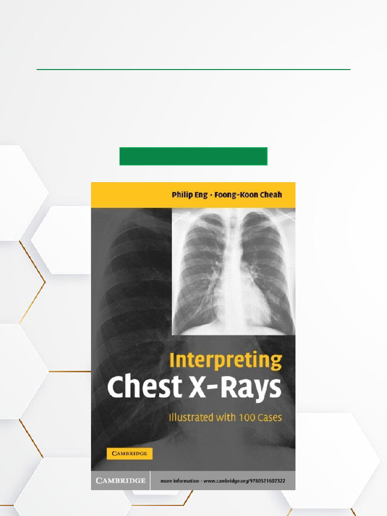 Interpreting Chest X-Rays: 100 Cases | PDF | Lung | Heart