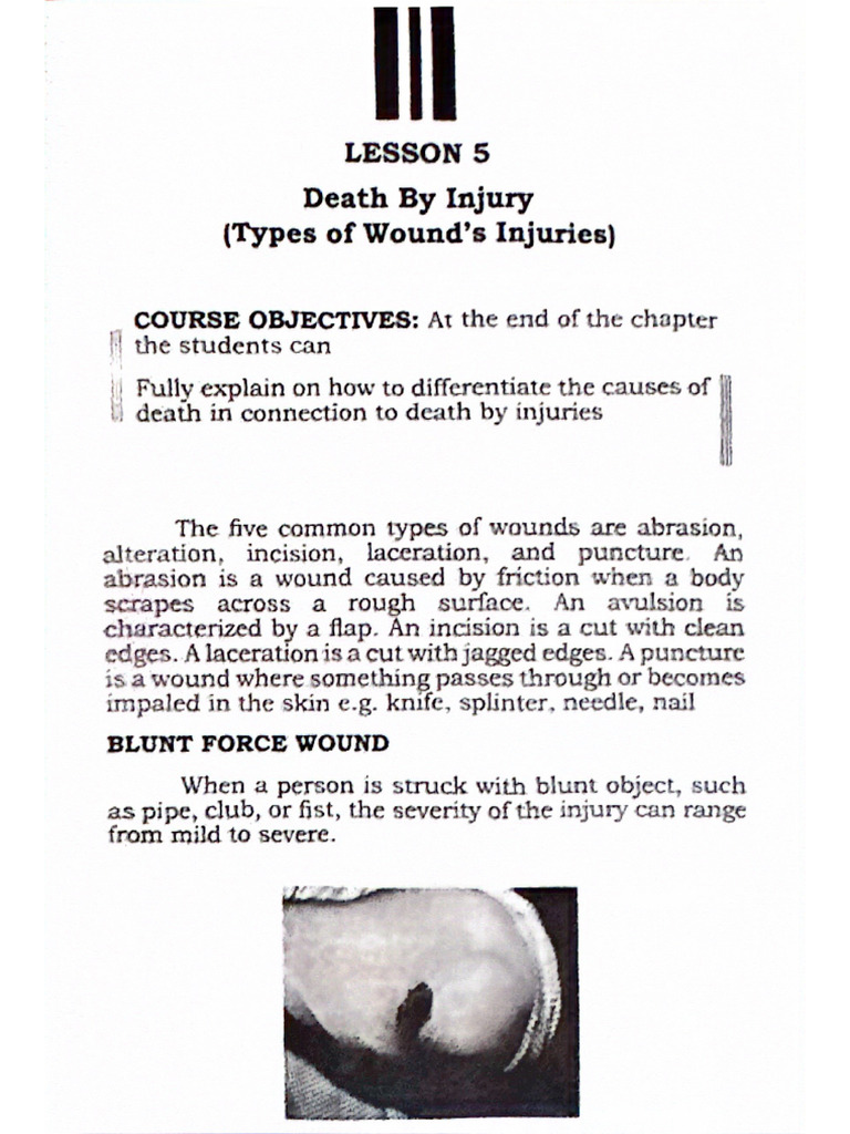 Types of Injury Special Crime Investig | PDF