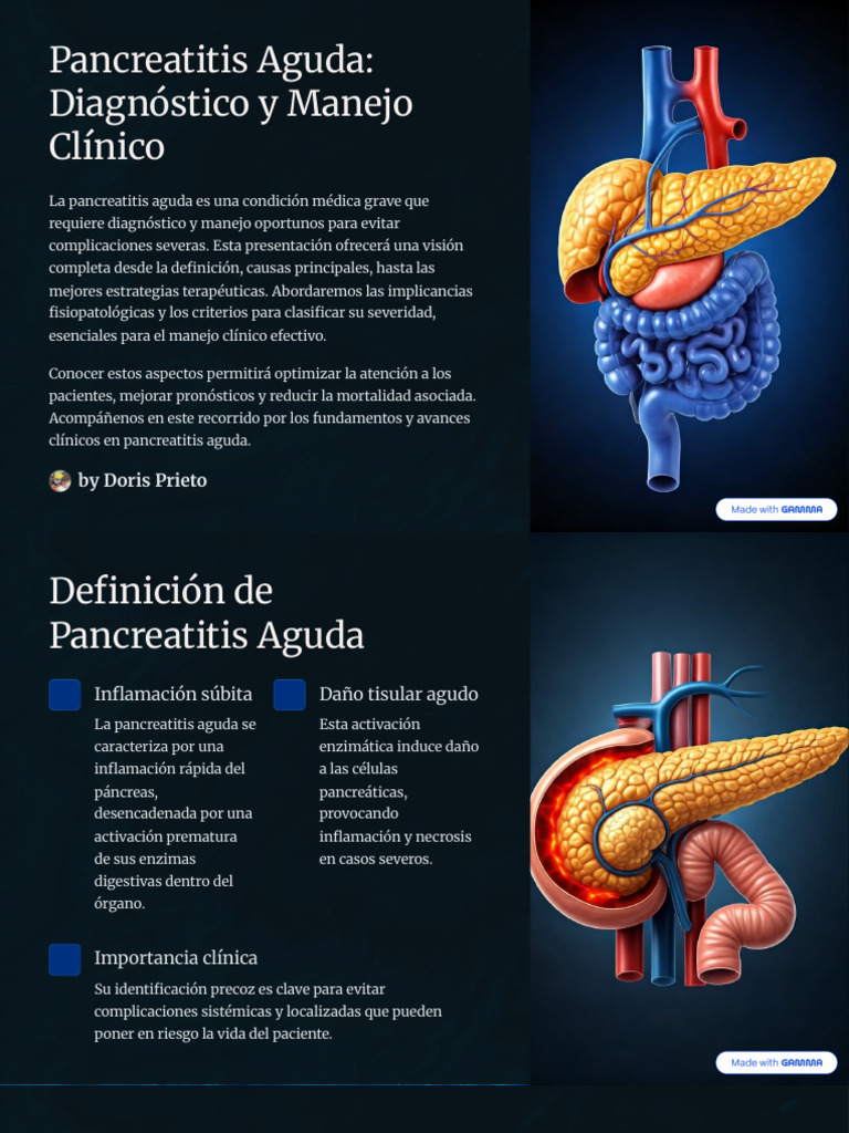 Pancreatitis Aguda Diagnostico y Manejo Clinico - 250520 - 124226 | PDF | Inflamación ...