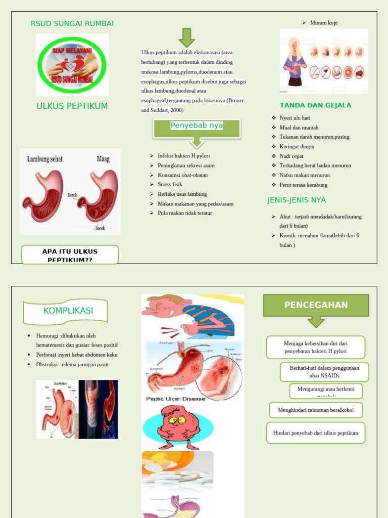 Leaflet Ulkus Peptikum | PDF