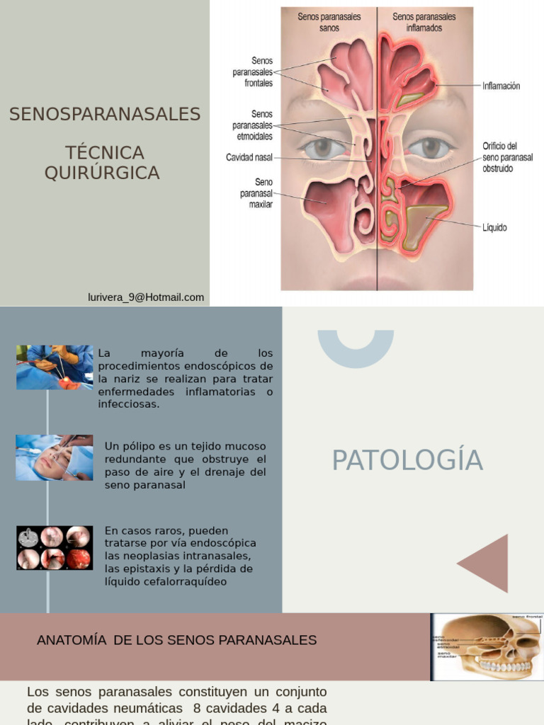 Ténica de Senos Paranasales | PDF | Anatomía humana | Especialidades ...