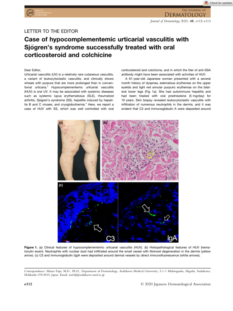 The Journal of Dermatology - 2020 - Fujii - Case of Hypocomplementemic ...