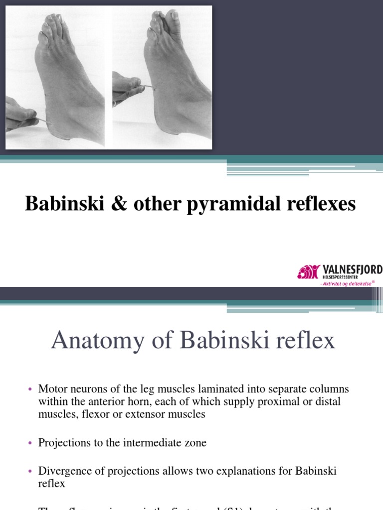 Babinski and Other Pyramidal Reflexes Without Videos | PDF | Foot | Anatomy