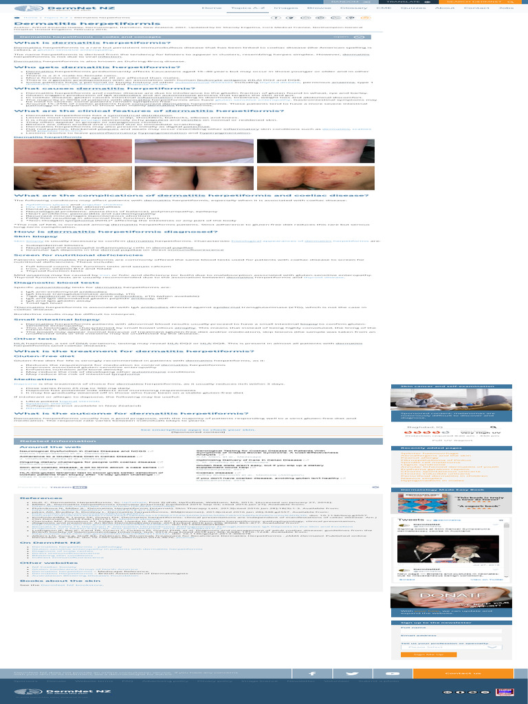 Dermatitis herpetiformis _ DermNet NZ | PDF | Coeliac Disease | Gluten ...