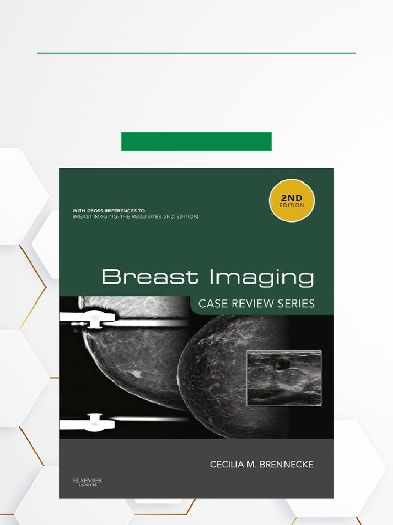Breast Imaging Case Review Series, 2nd Edition Fast Download | PDF ...