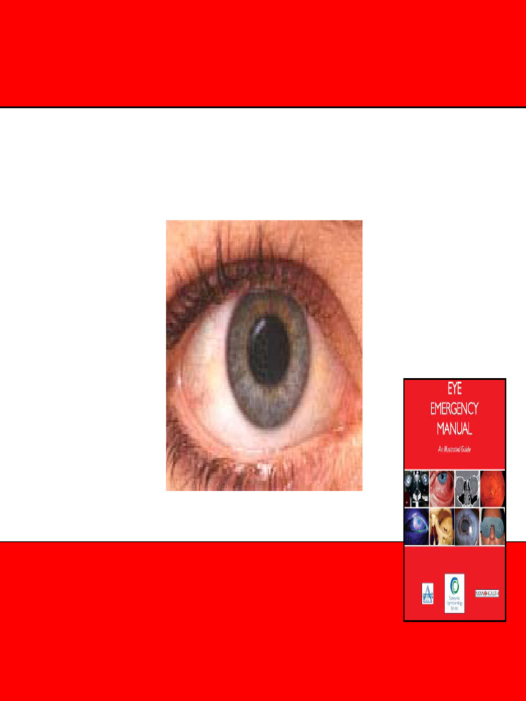 Eem Education Session3 | PDF | Visual Acuity | Glasses