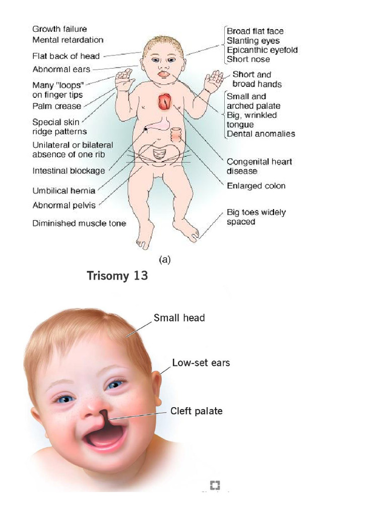 Syndromes | PDF