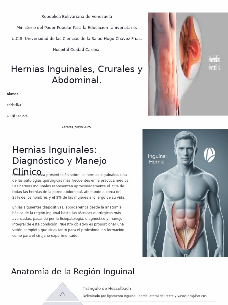 Hernias Inguinales, Crurales y Abdominal | PDF | Enfermedades y trastornos | Medicina CLINICA