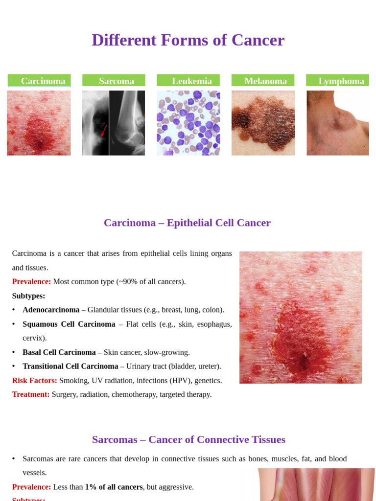 Cancer Biology PPT 2 | PDF | Leukemia | Cancer
