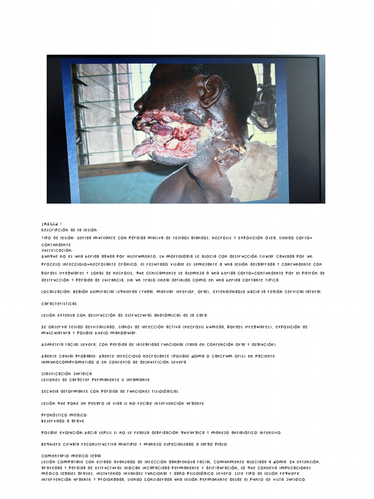 Medicina Legal Y Forense - Parte de Lesiones | PDF | Herida | Especialidades Medicas