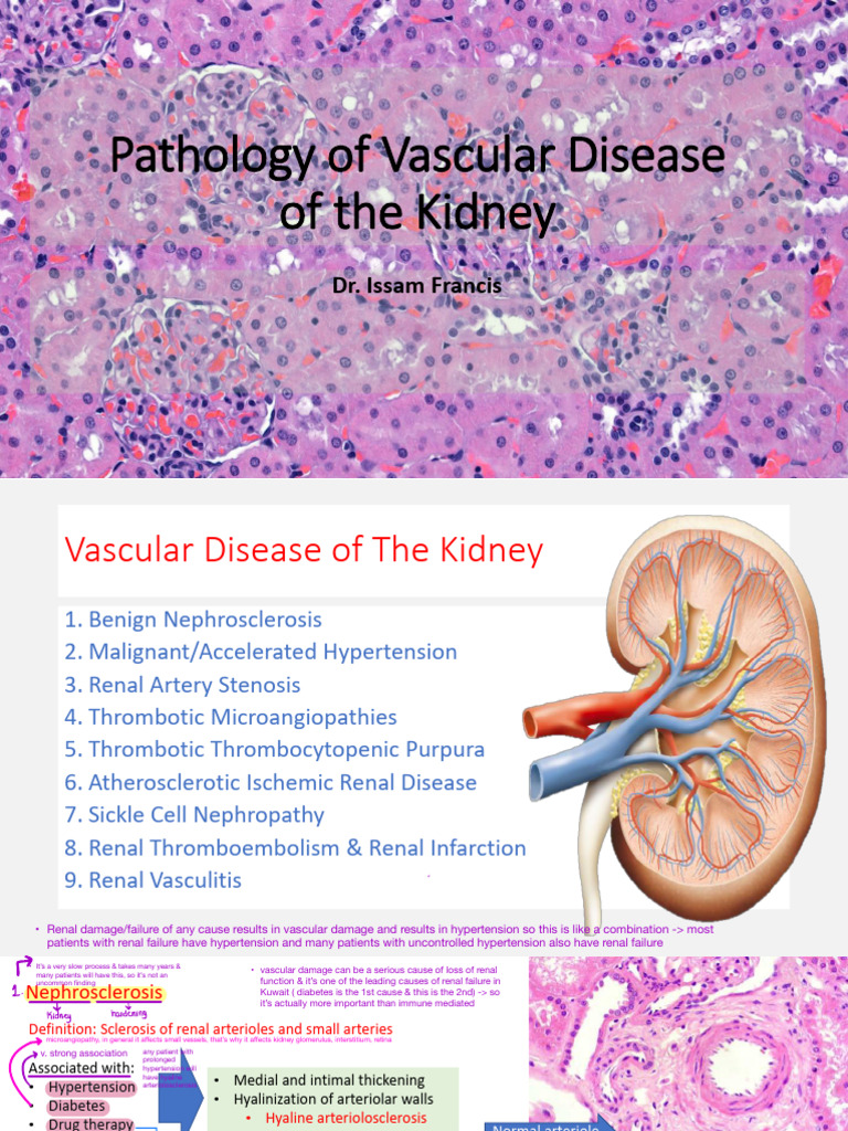 Vascular Disease of The Kidney-4 | PDF | Ischemia | Thrombosis