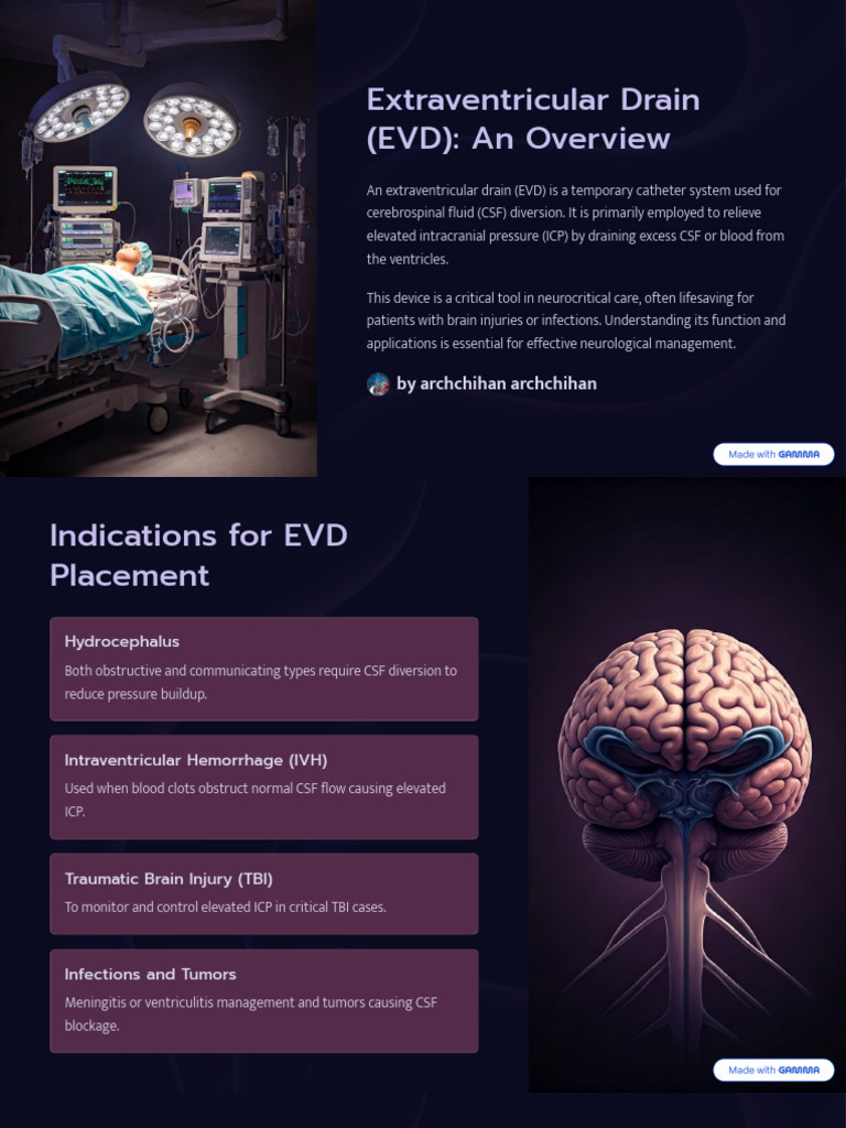 Extraventricular Drain EVD An Overview | PDF | Medical Specialties ...