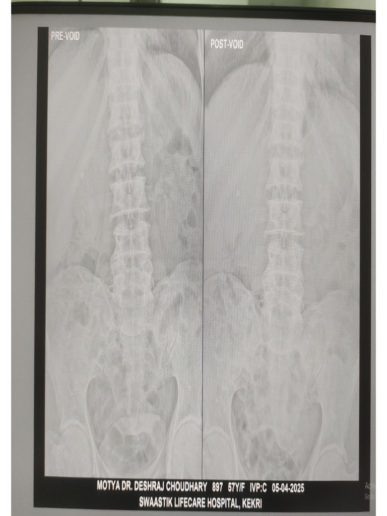 Motita Ivp Film | PDF