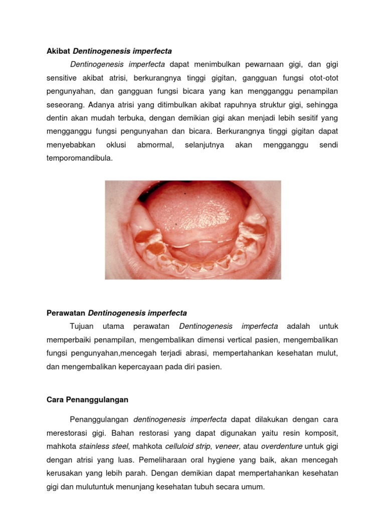Akibat Dentinogenesis Imperfecta | PDF