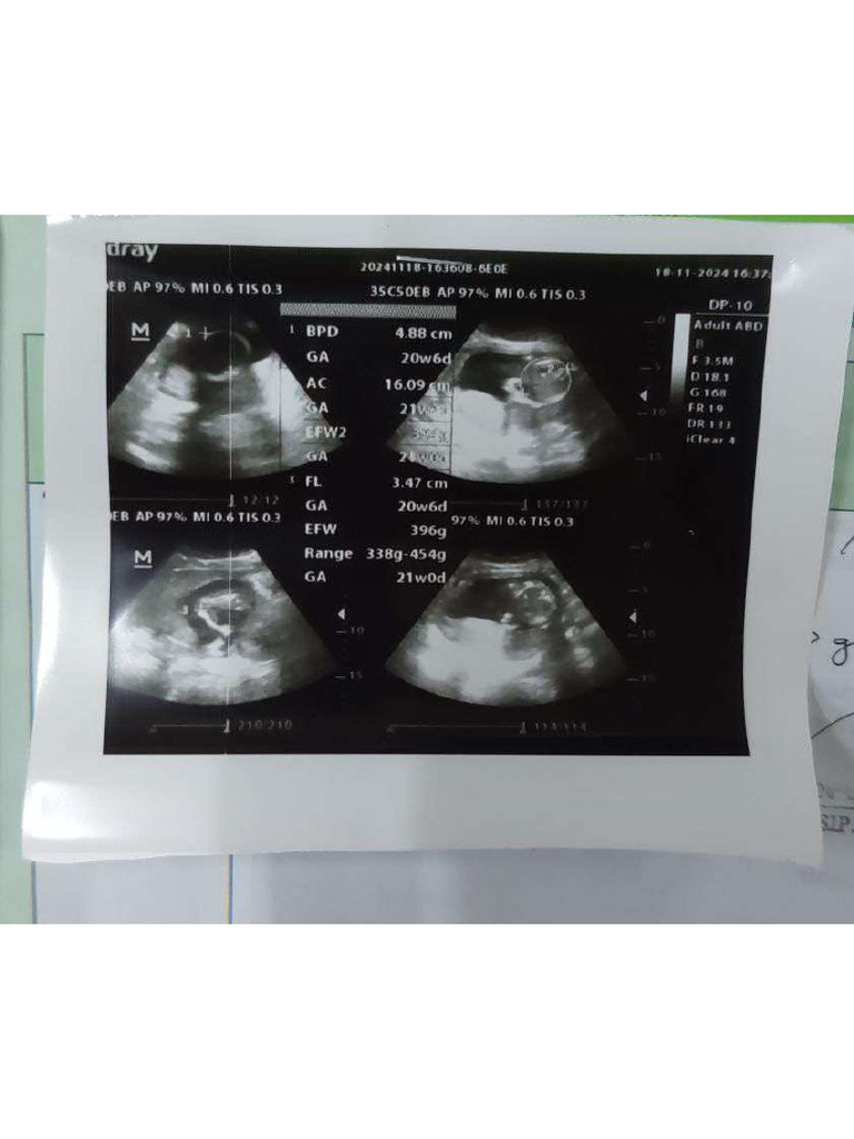 TELAAH - DEWI SOPIYAH - Laporan - Hasil - USG | PDF