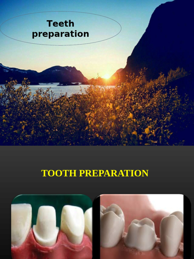 DR Nahed Teeth Preparation | PDF | Dentistry | Tooth