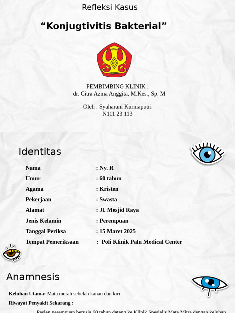 Refka Konjugtivitis | PDF