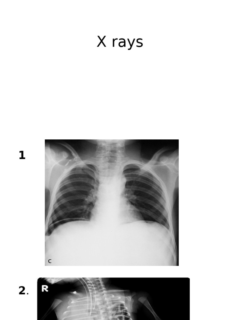 XRAYS-1 | PDF