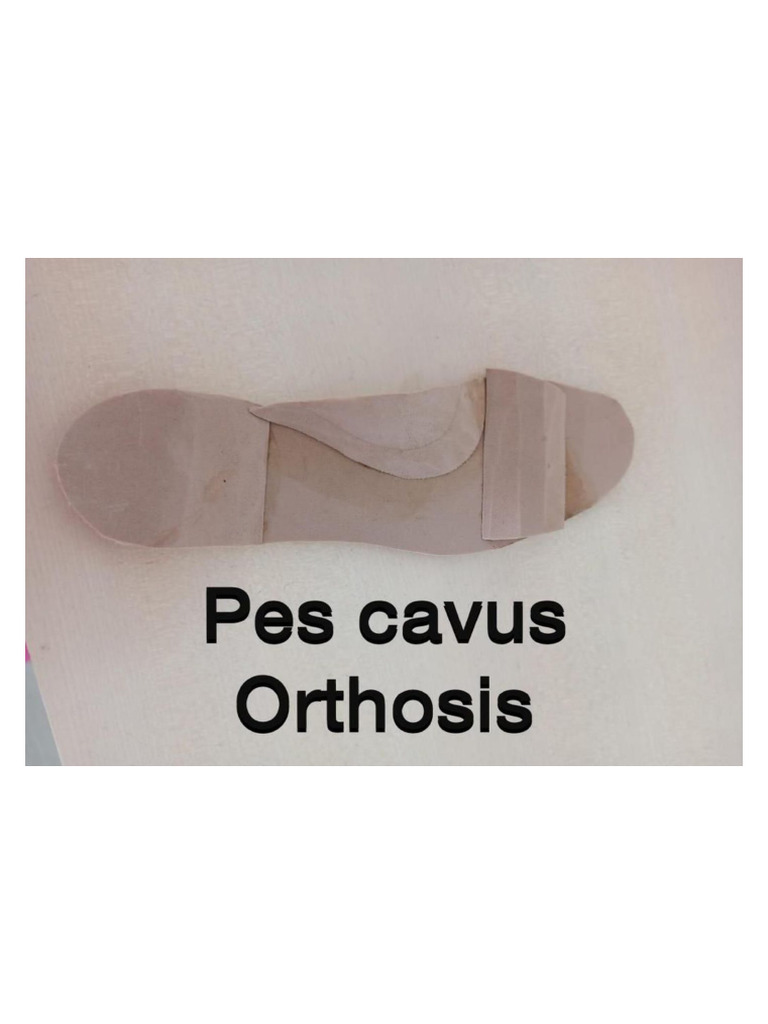 Orthosis Prosthesis | PDF