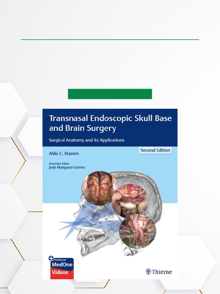Transnasal Endoscopic Skull Base and Brain Surgery Surgical Anatomy and ...
