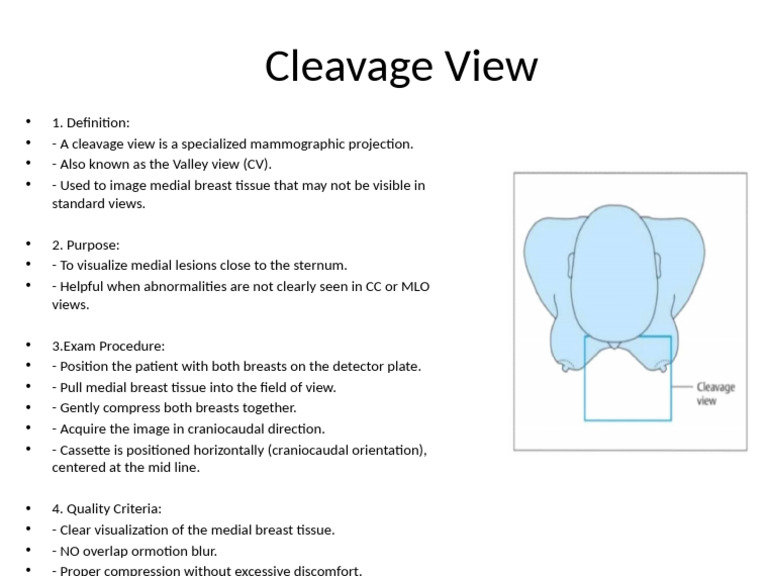 Mammography Cleavage View | PDF