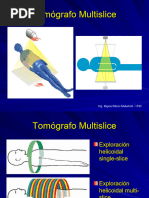 Pitch y TC Helicoidal | PDF | Ct Scan