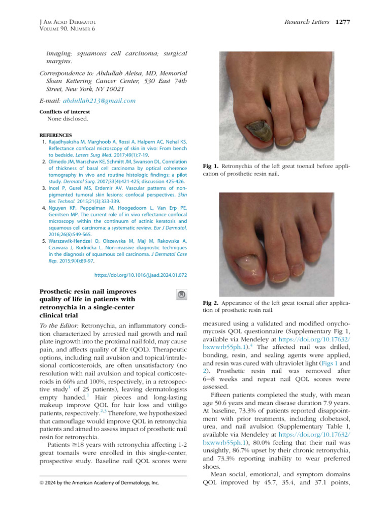 Prosthetic Resin Nail Improves Quality of Life in | PDF | Nail (Anatomy ...