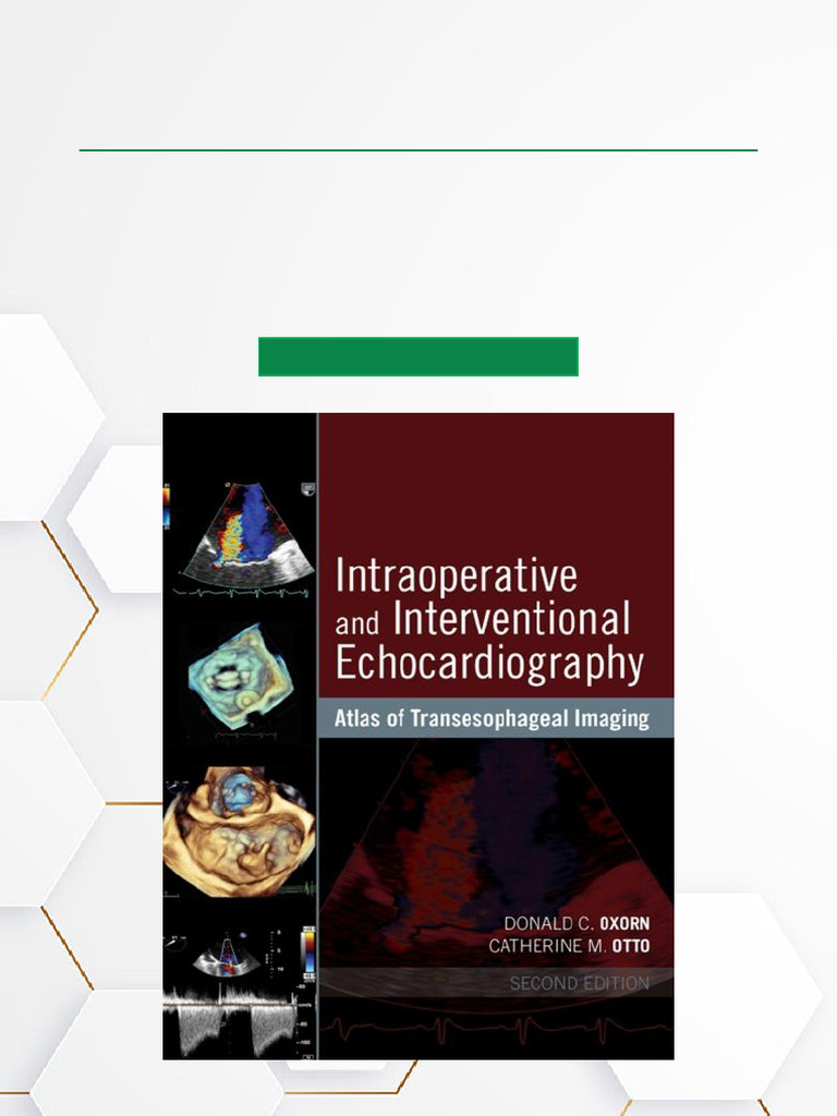 Intraoperative and Interventional Echocardiography Atlas of ...