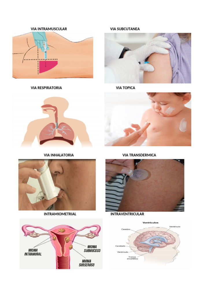 Via Intramuscular Via Subcutanea | PDF