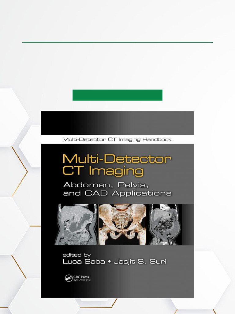 Multi Detector CT Imaging Abdomen, Pelvis, and CAD Applications 1st ...