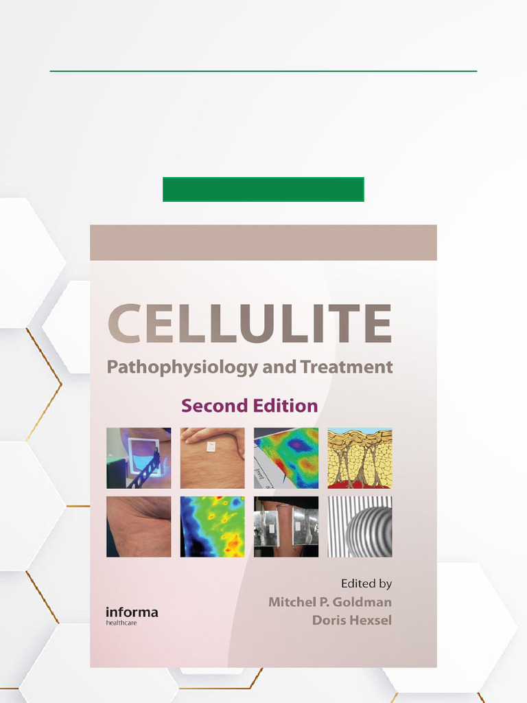 Cellulite: Pathophysiology & Treatment | PDF | Self Esteem | Dermatology