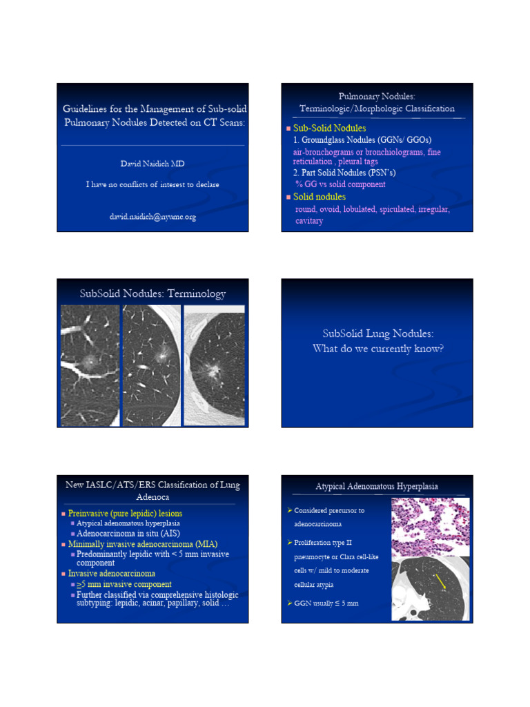 02 - Sam Part 2 - Subsolid Nodules Significance and Management ...