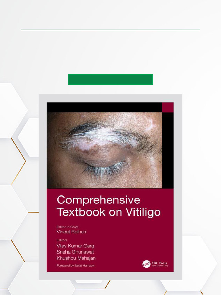 Comprehensive Textbook on Vitiligo | PDF | Dermatology | Copyright