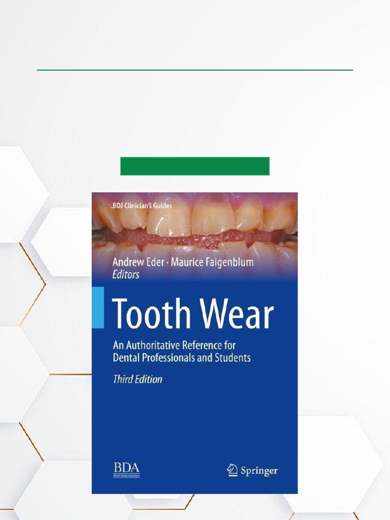 Tooth Wear An Authoritative Reference For Dental Professionals and ...