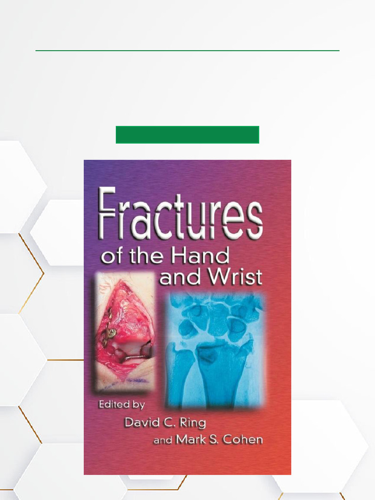 Fractures of The Hand and Wrist, 1st Edition Final Version Download ...