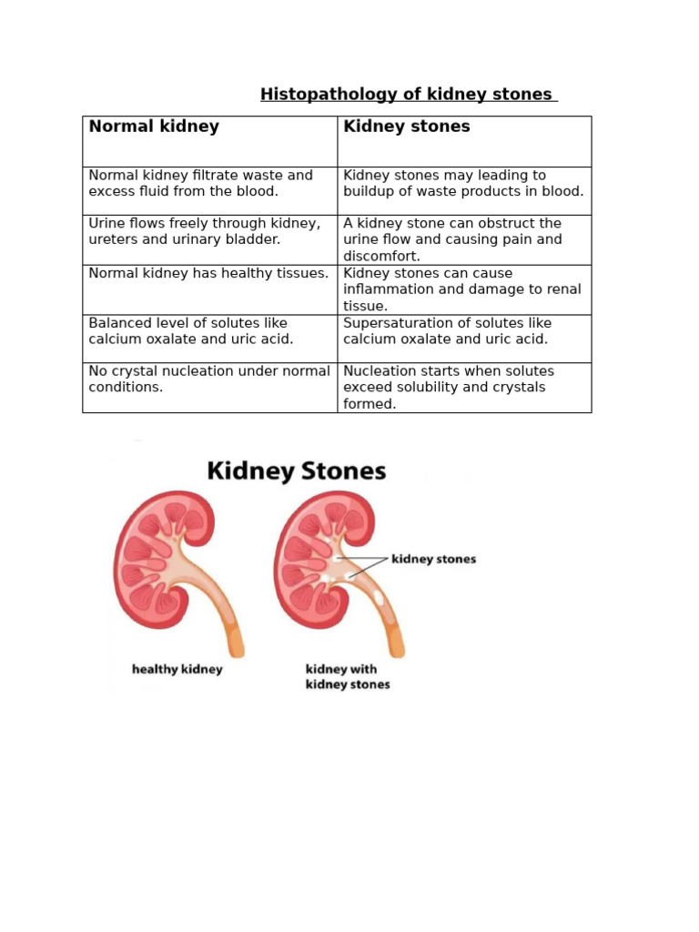 Histopathology of Kidney Stones Normal Kidney Kidney Stones | PDF