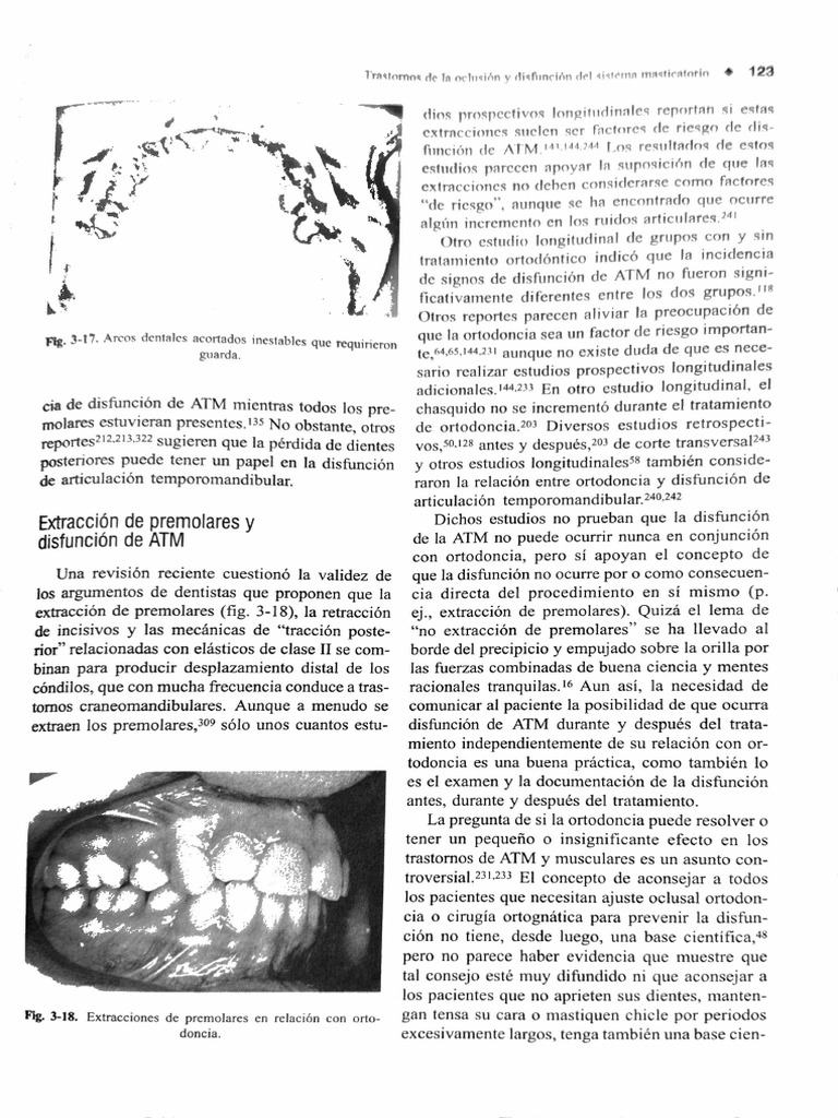 Oclusion de Okenson Cap 2 | PDF